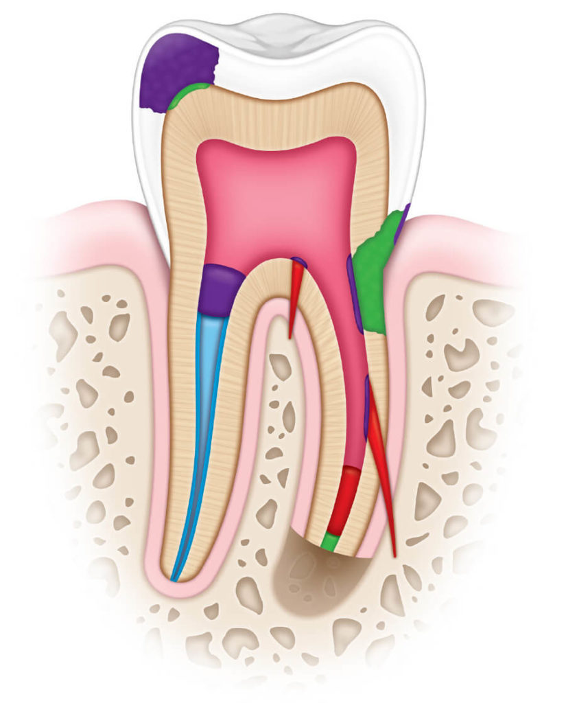 EndoSequence Bioactives - Brasseler USA - Dental