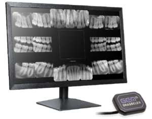 GEM Digital X-Ray Sensor | Brasseler USA