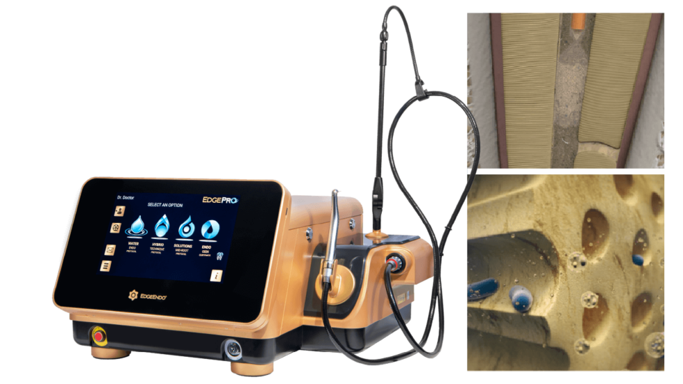 EdgePro Endodontic Laser | Brasseler USA